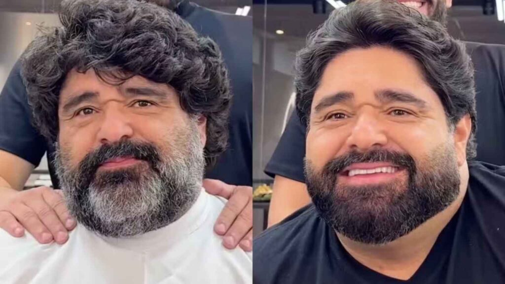 Fabiano Menotti exibe nova aparência após perder 40 kg e rejuvenescer o ...
